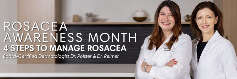 Rosacea Awareness Month: 4 Steps to Manage Rosacea - Optima Dermatology